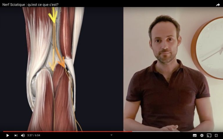 Le nerf sciatique : Définition, trajet et anatomie