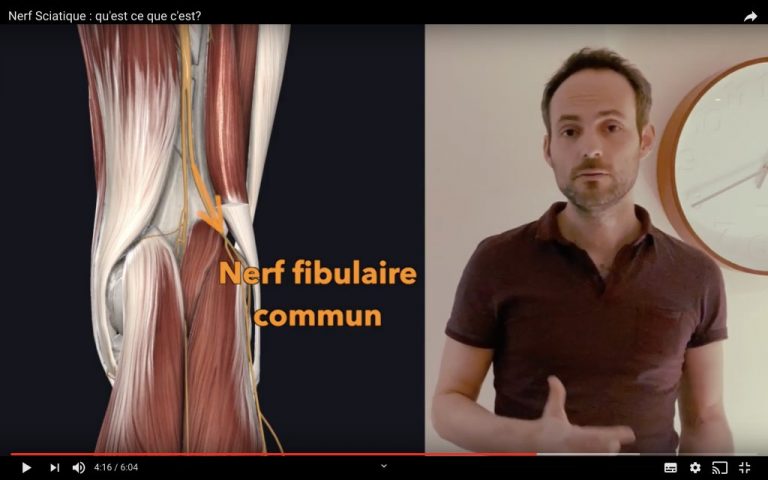 Le nerf sciatique : Définition, trajet et anatomie