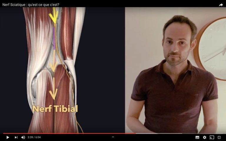 Le nerf sciatique : Définition, trajet et anatomie